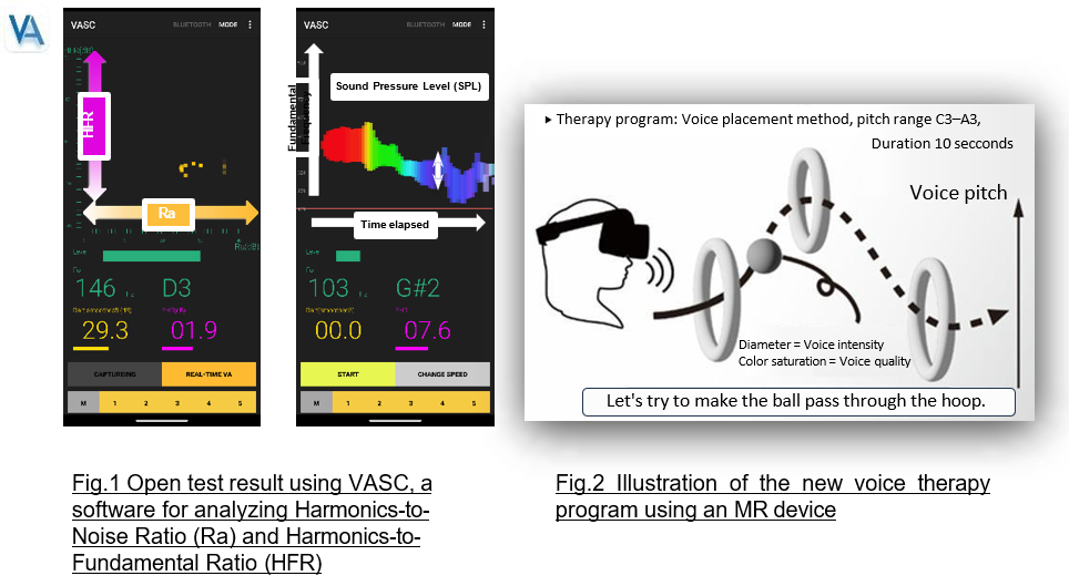 Real-Time Vocal Analysis and Visualization Technology for Voice Therapy ...